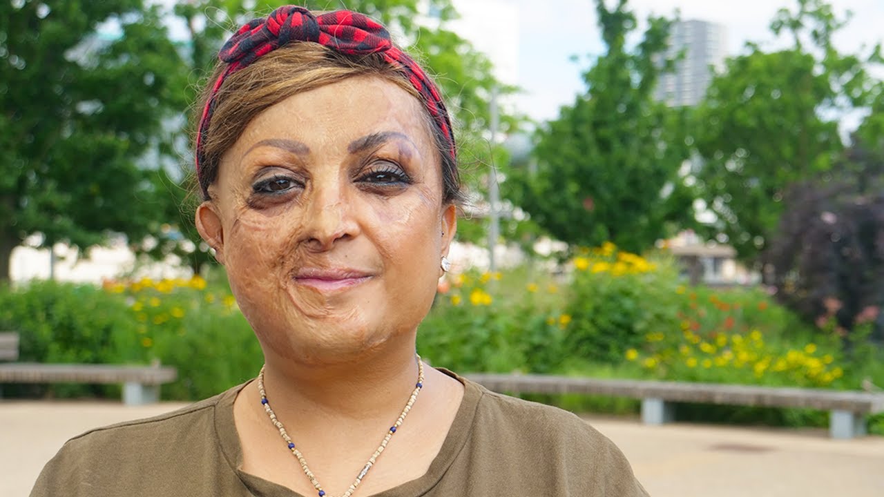 Tulsi Vagjiani: A transformative skin story - CellDerma USA